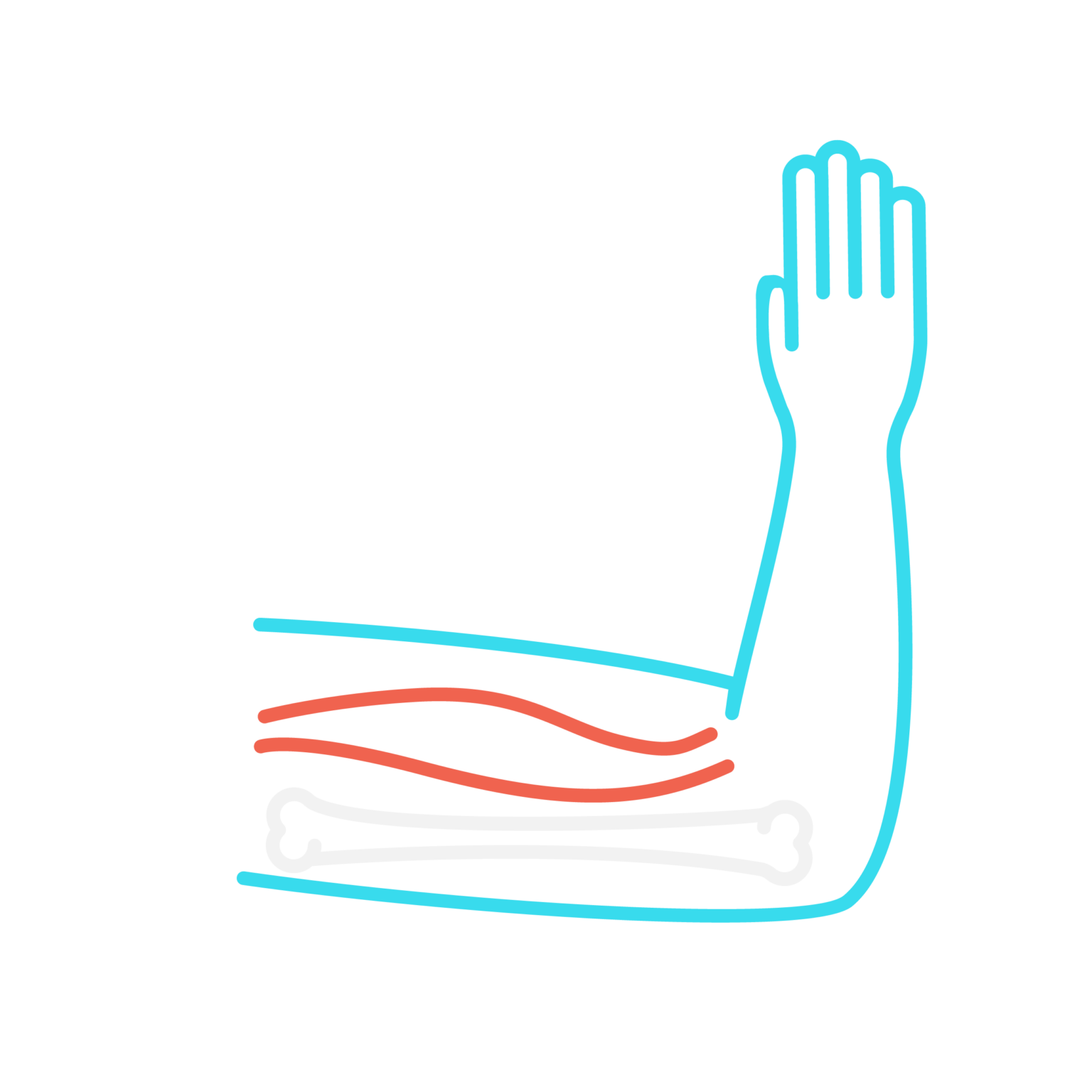 Simons Searchlight | PHF21A-Related Syndrome